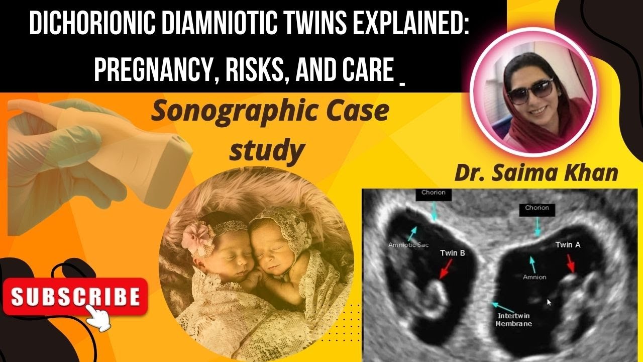 Dichorionic Diamniotic Twins Explained: Pregnancy, Risks, and Care @Dr ...