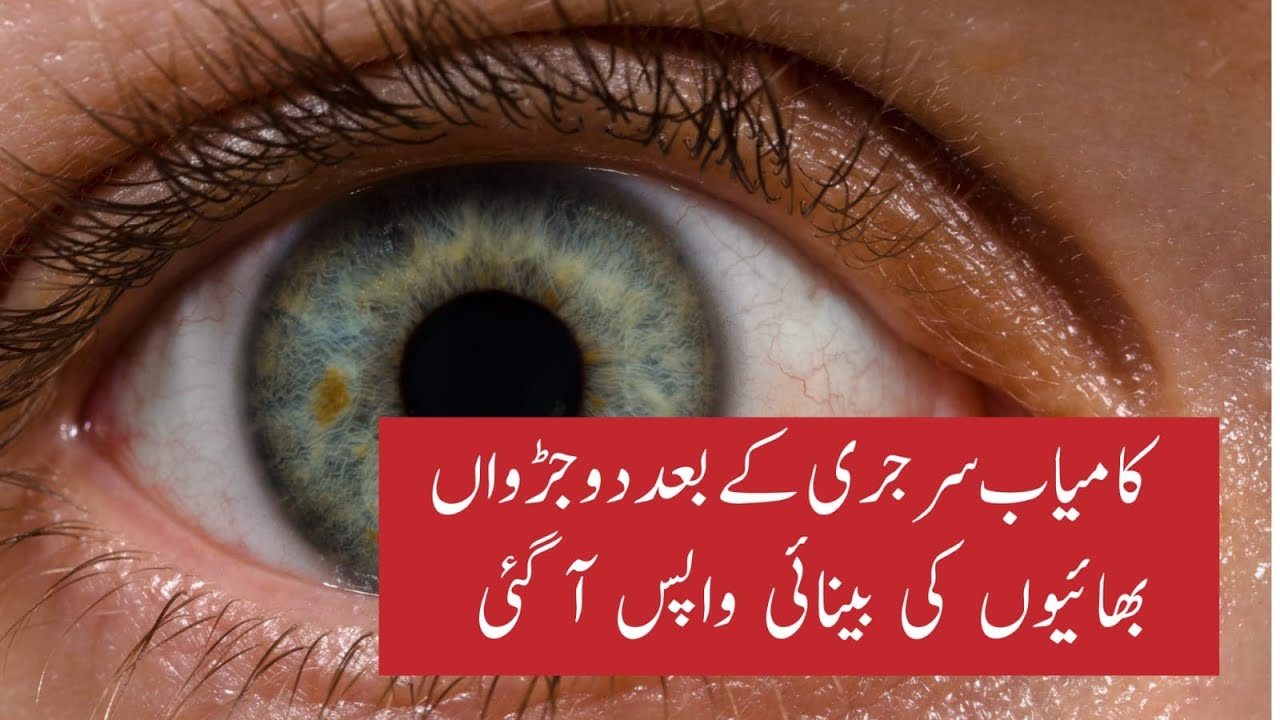 Two twin brothers have regained their sight after successful surgery ...