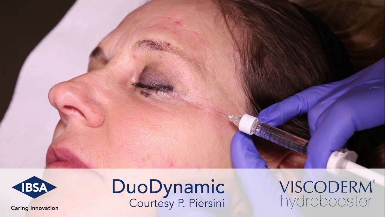 Viscoderm Hydrobooster - DuoDynamic Technique Periocular Area - YouTube