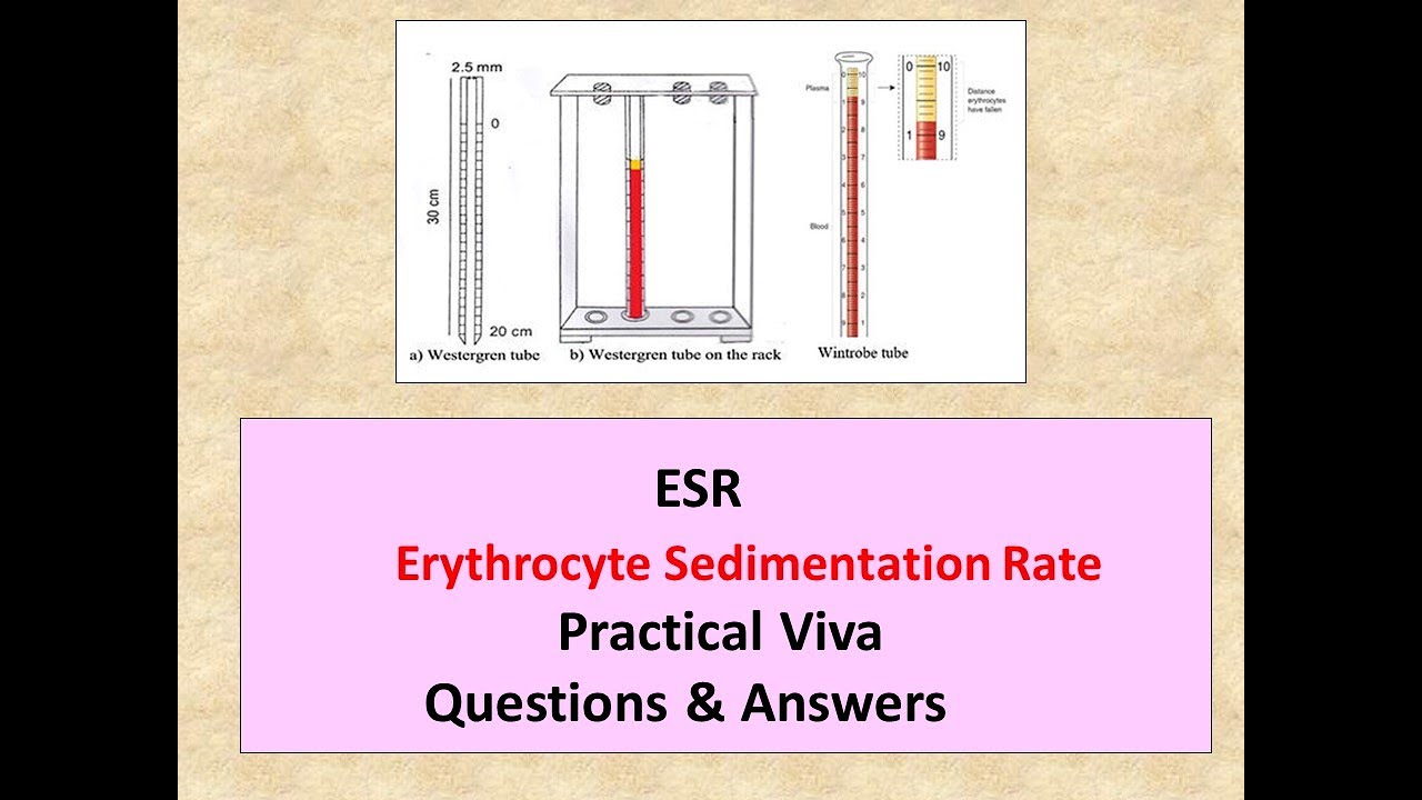 ESR test l Erythrocyte Sedimentation rate test l Practical Viva l High ...