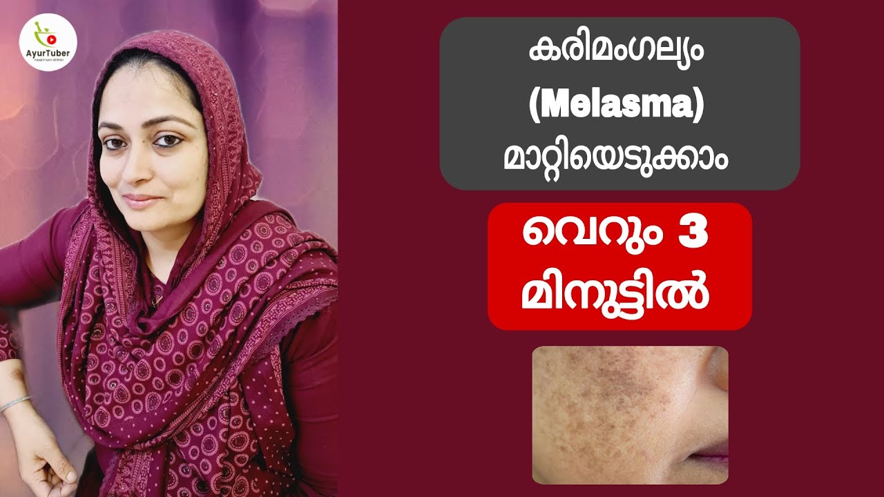 How To Get Rid Of Melasma Naturally In Just 3 Minutes! - YouTube