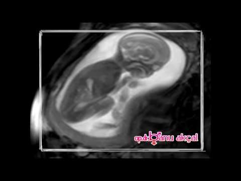 Anne Karnındaki Bebeğin Hareketleri