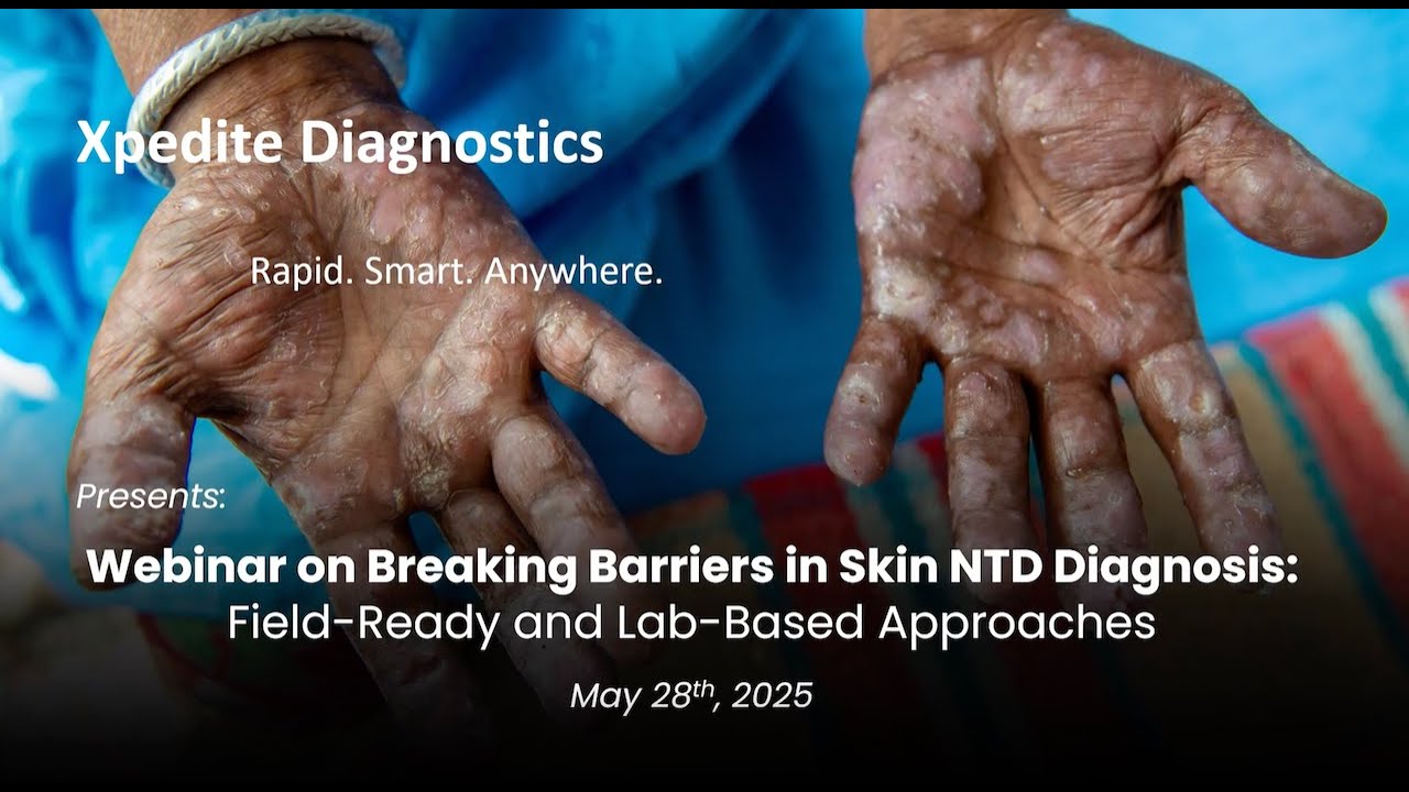 Breaking Barriers in Skin NTD Diagnosis: Field-Ready and Lab-Based ...