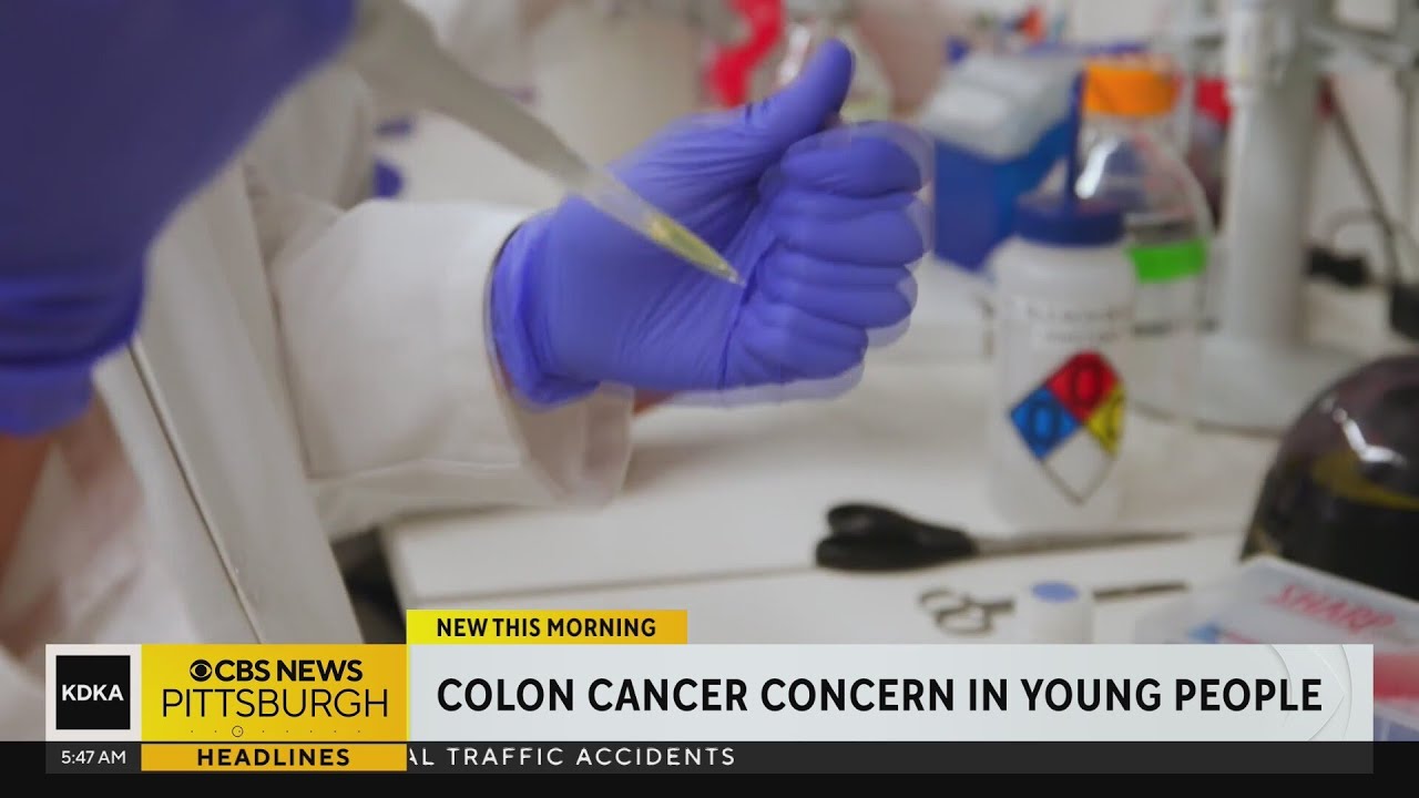 Colon cancer concern in young people - YouTube
