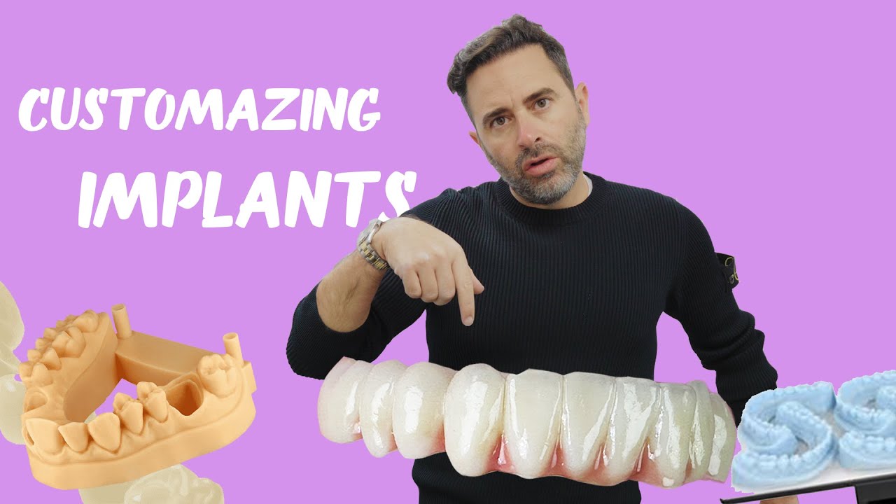 #2 How to paint implants? Customize White in Teeth Restoration - YouTube