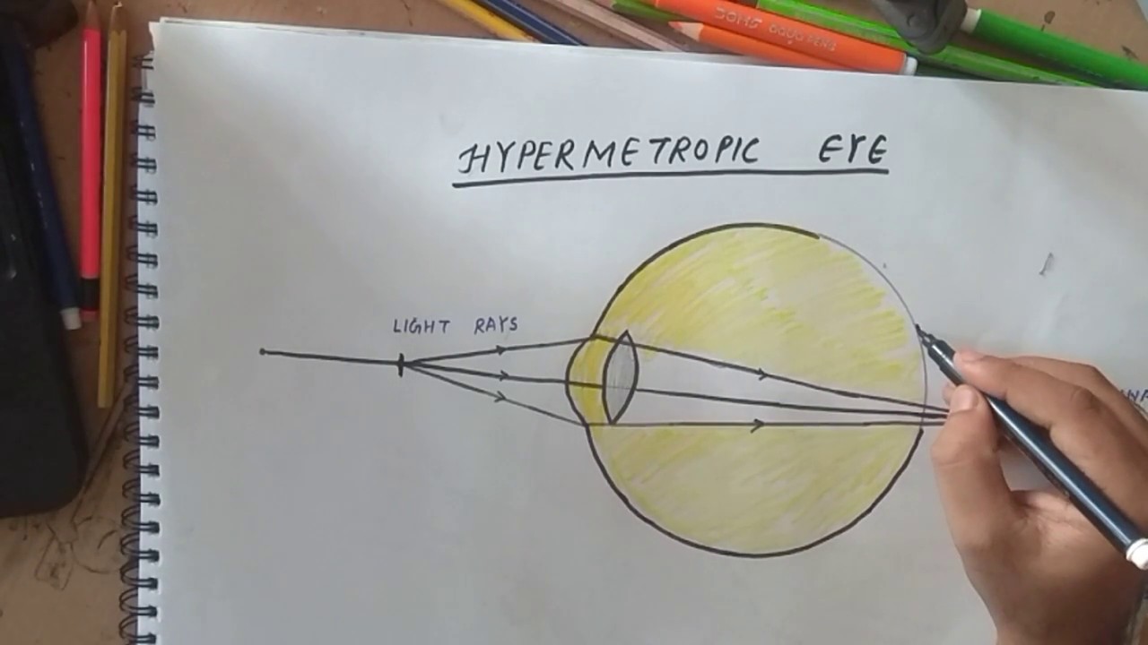 How to draw hypermetropia eye - YouTube