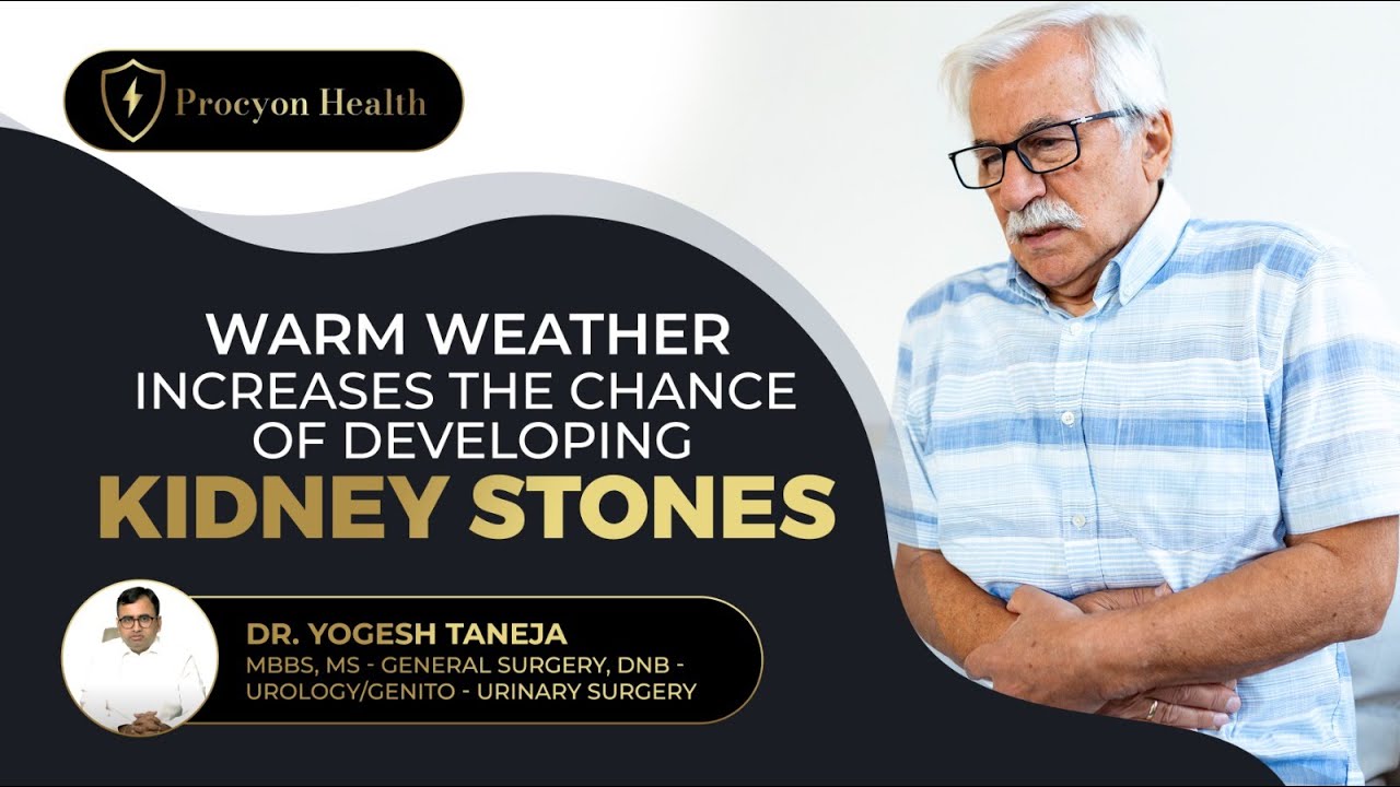 Warm Weather Increases the Chance of Developing Kidney Stones | Dr ...