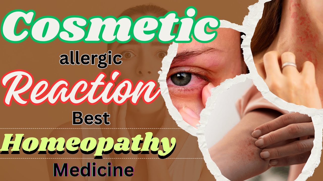 Allergic reaction rash | How to treat allergic reaction on face | skin ...