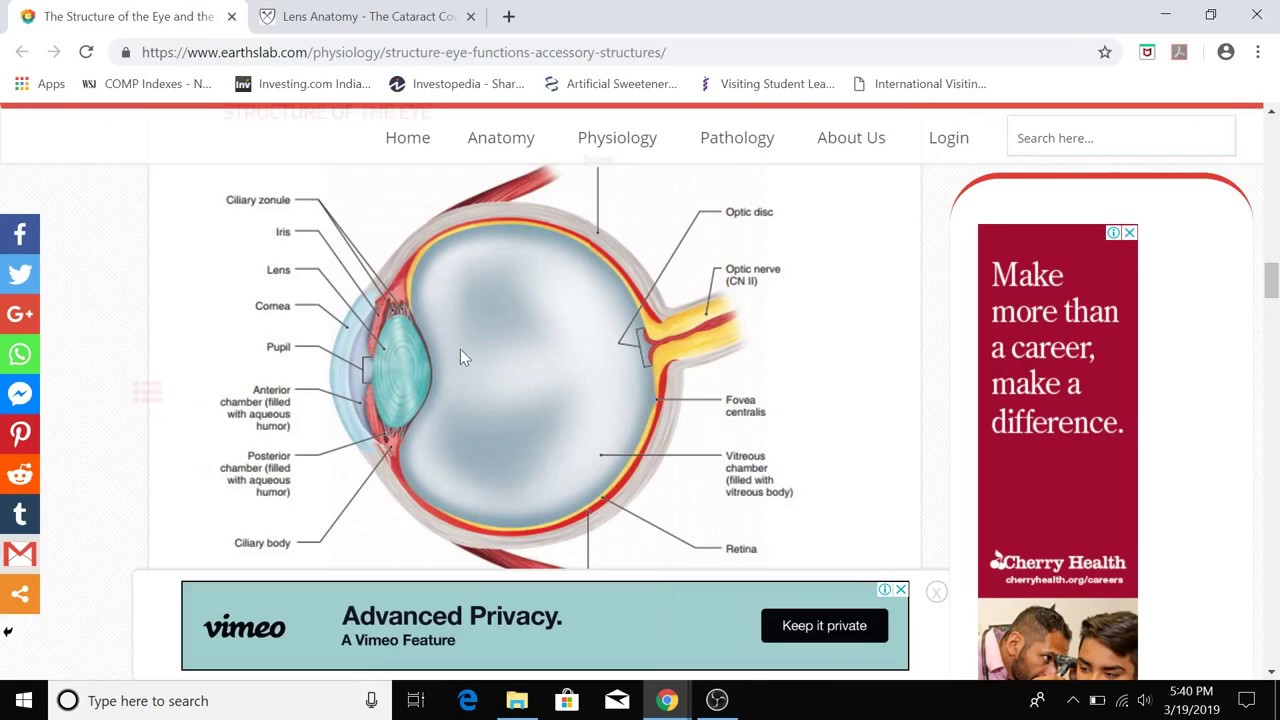 Why is iris shadow only visible in immature cataract? - YouTube