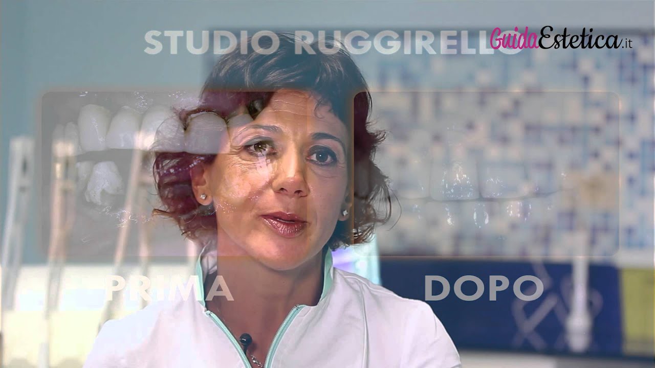 L'Implantologia dentale per recuperare il nostro sorriso - YouTube