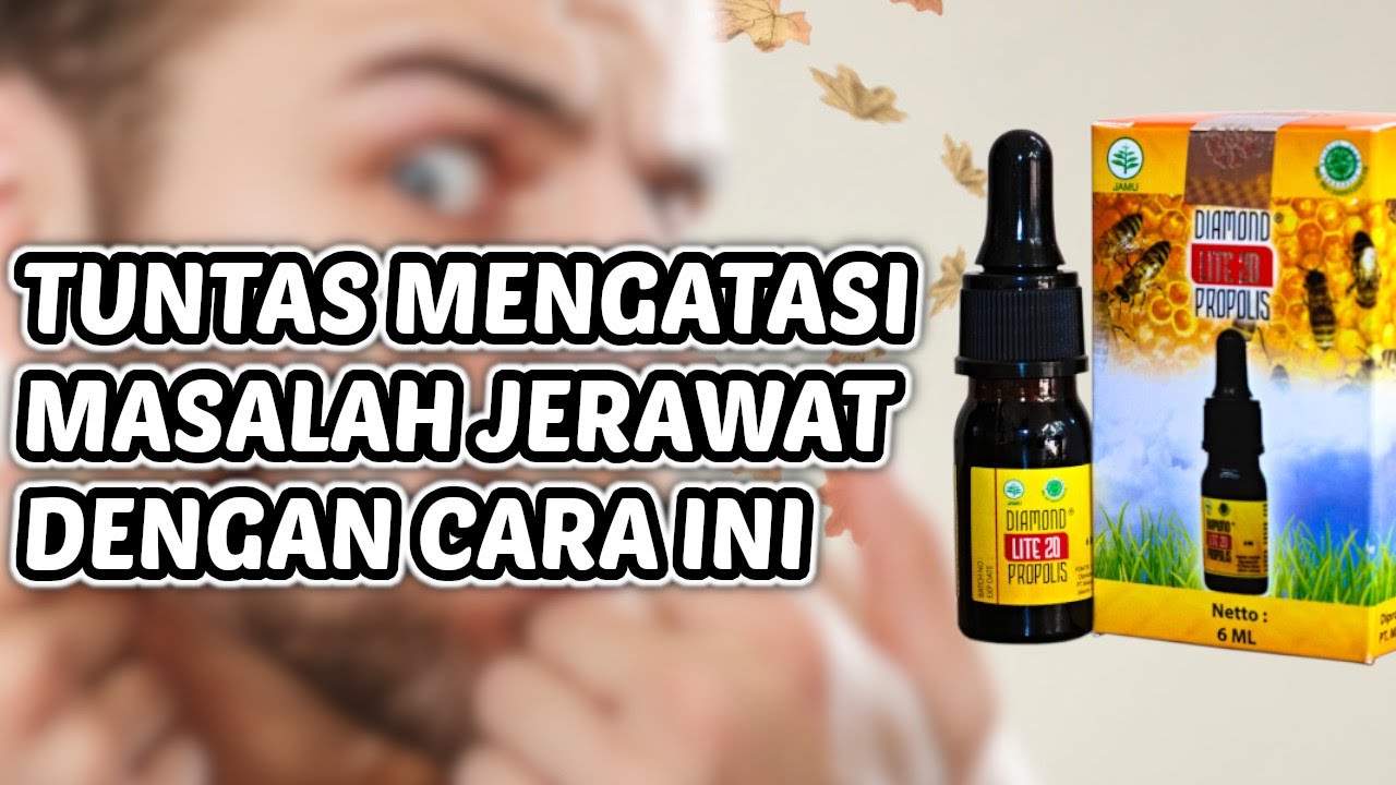 CARA MENGATASI JERAWAT DENGAN BAHAN ALAMI | PROPOLIS DIAMOND LITE - YouTube