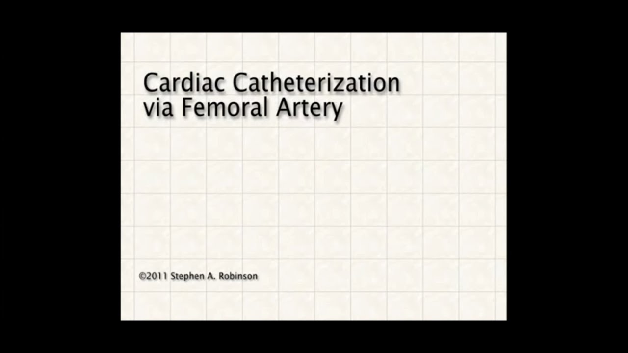 CARDIAC CATHETERIZATION via FEMORAL ARTERY - YouTube