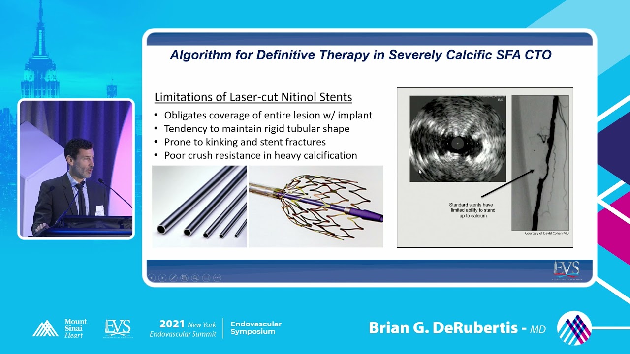 9h20 EVS october 15 2021 Brian G DeRubertis, MD My Algorithm for ...
