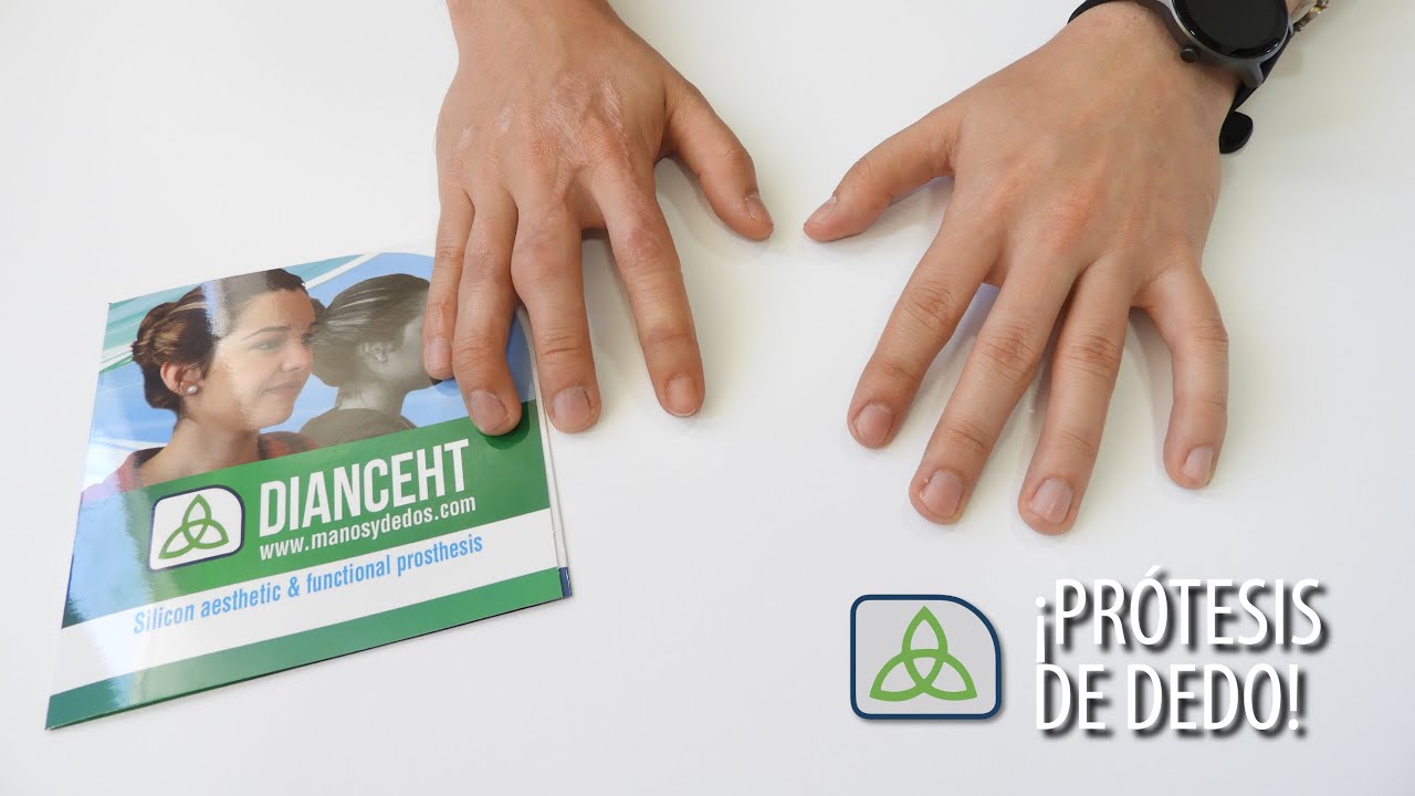 Prótesis de dedo / Finger prosthesis No. 262 - YouTube
