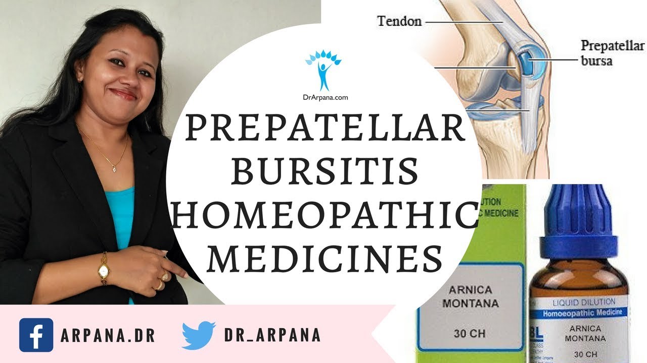 बर्साइटिस बर्सा के लक्षण व होम्योपैथिक इलाज || PREPATELLAR BURSITIS Homeopathic Medicines - YouTube