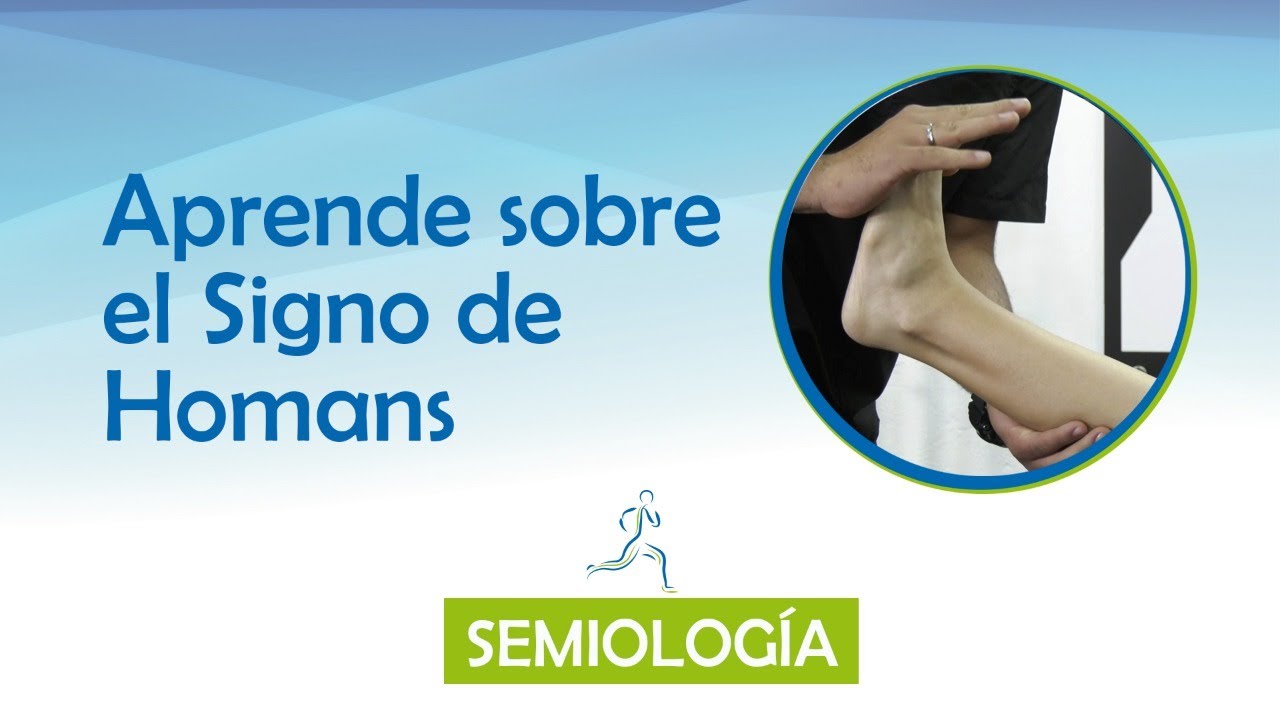 Signo de Homans - YouTube