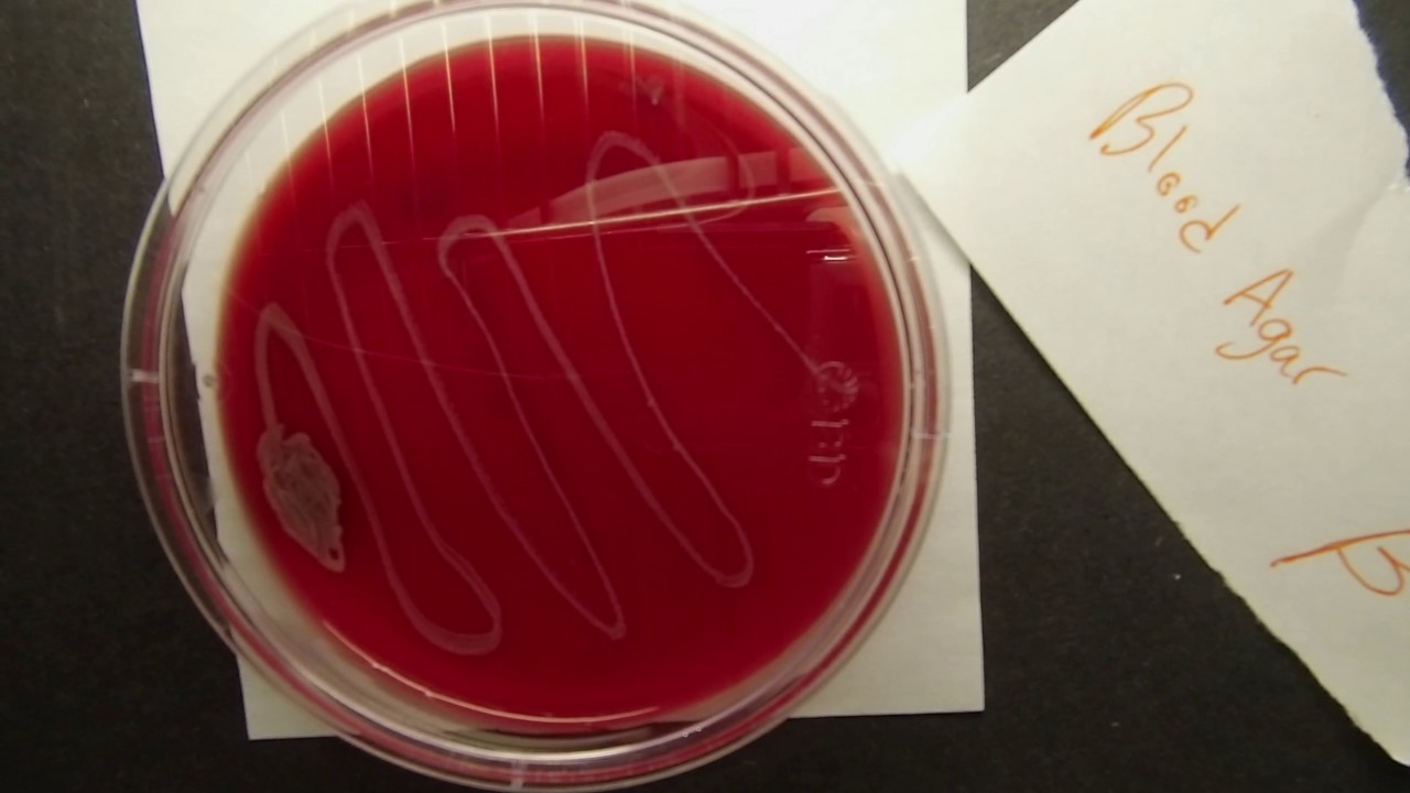 Beta Hemolysis Staphylococcus aureus-Blood Agar - YouTube