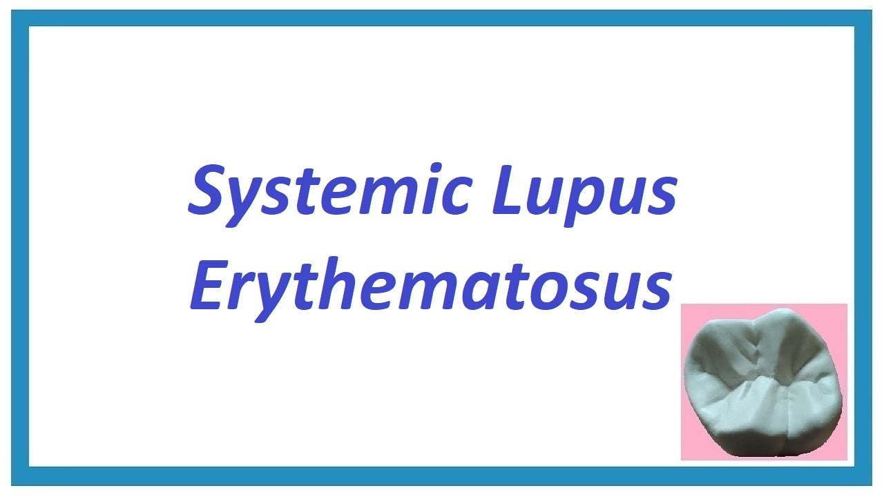 Systemic Lupus Erythematosus | Oral Pathology | Dental Occlusion - YouTube