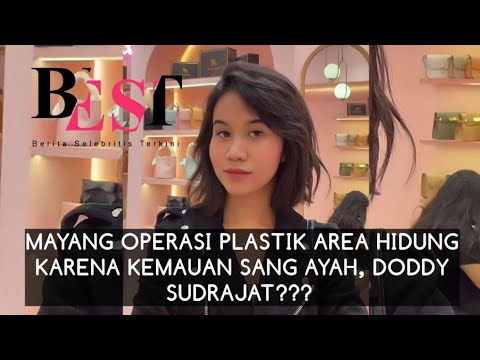 MAYANG LUCYANA FITRI LAKUKAN OPERASI PLASTIK HIDUNG AGAR MANCUNG - YouTube