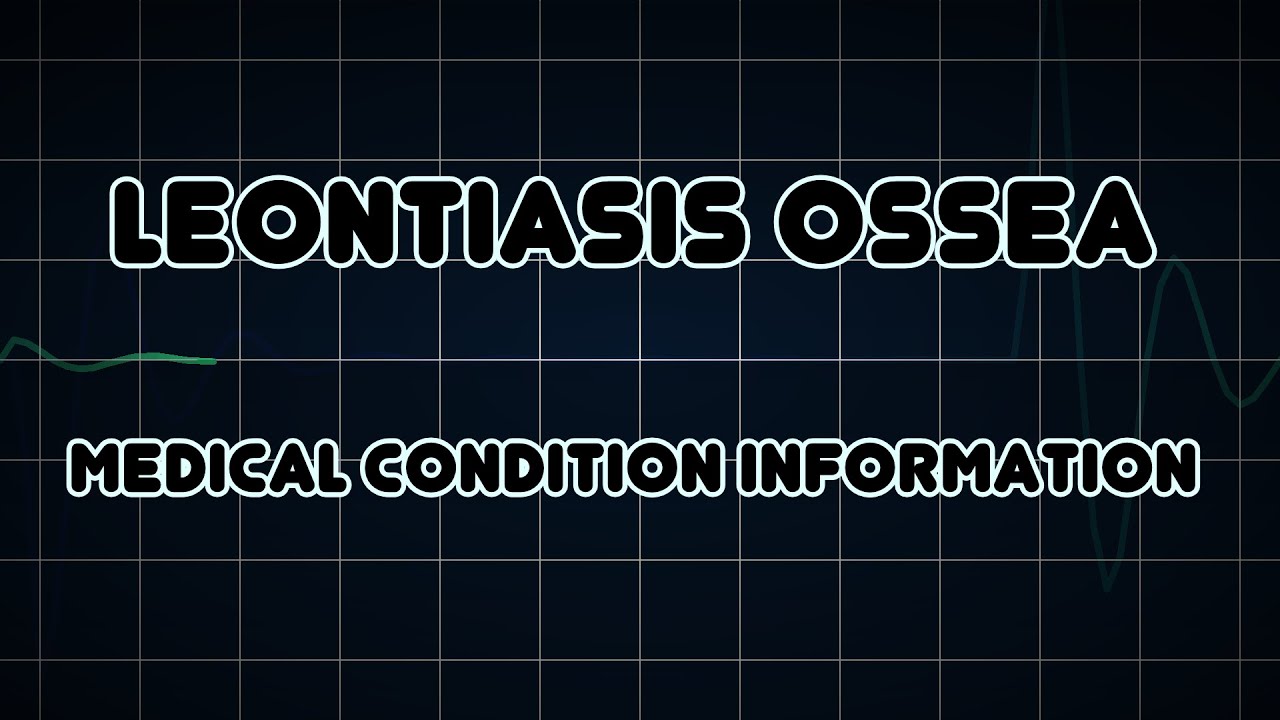 Leontiasis ossea (Medical Condition) - YouTube