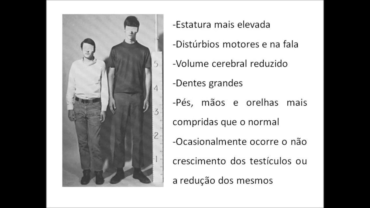 Xxyy Syndrome Symptoms