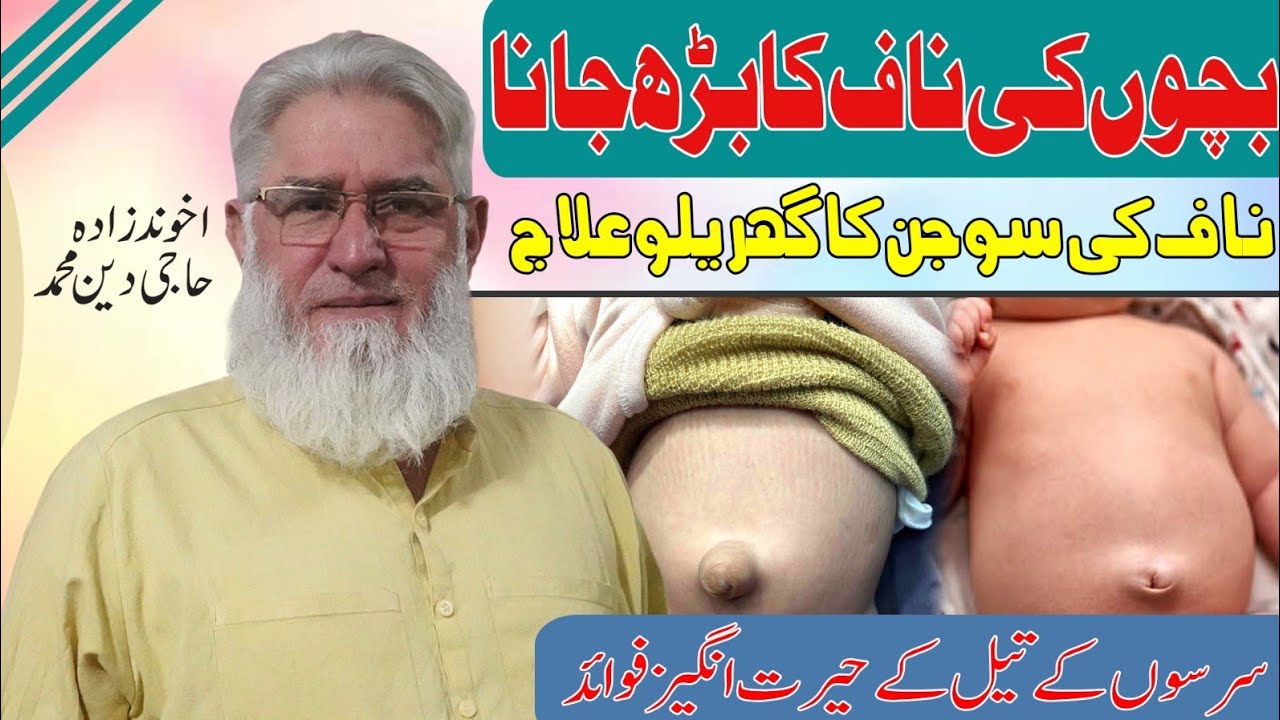 Bachon ki Naaf ki Sojan ka ilaj | Akhund zanda Haji Deen Muhammad - YouTube