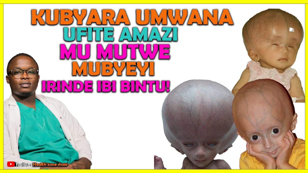 KUBYARA UMWANA UFITE AMAZI MU MUTWE// IRINDE IBI BINTU UTAZABYARA ...
