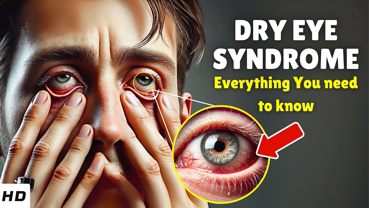 Dry Eye Syndrome: Causes, Signs and Symptoms & Treatments You NEED to ...