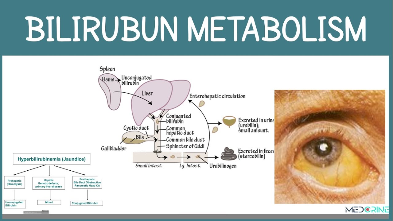 Bilirubin Metabolism and fate or Red Blood Cells Simplified - YouTube