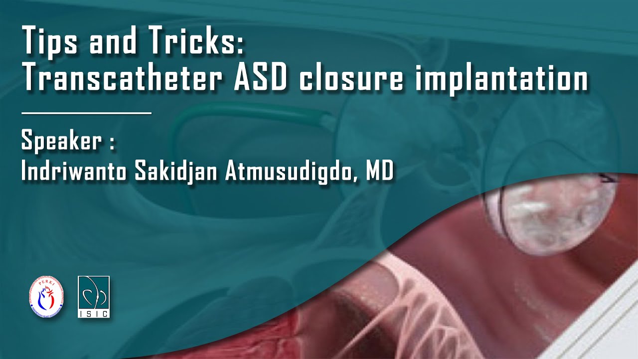 Tips and Tricks: Transcatheter ASD closure implantation - YouTube