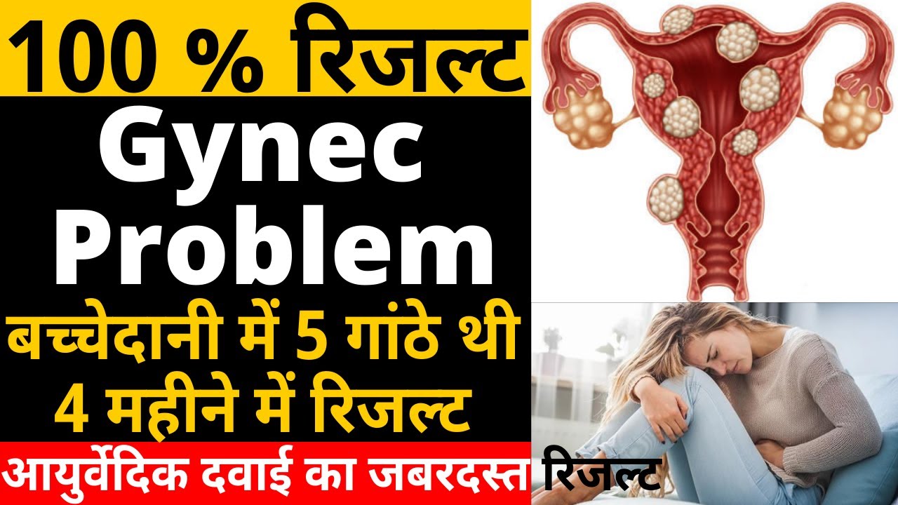 bacha dani ki ganth ka ilaj | bachedani me ganth kaise hota hai ...