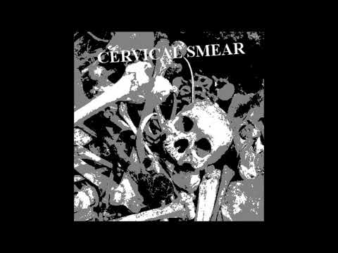 Cervical Smear - Ptomain Meditation - YouTube
