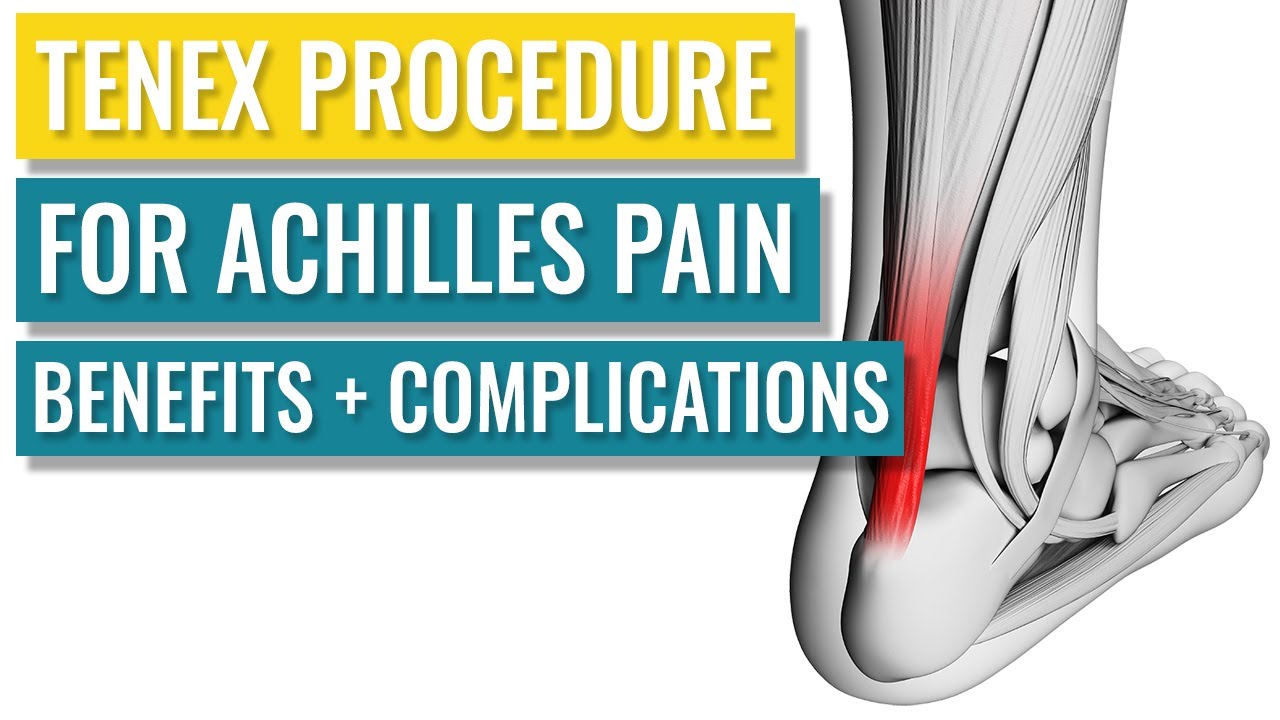 Tenex for Achilles Tendonitis - Benefits & Complications - YouTube