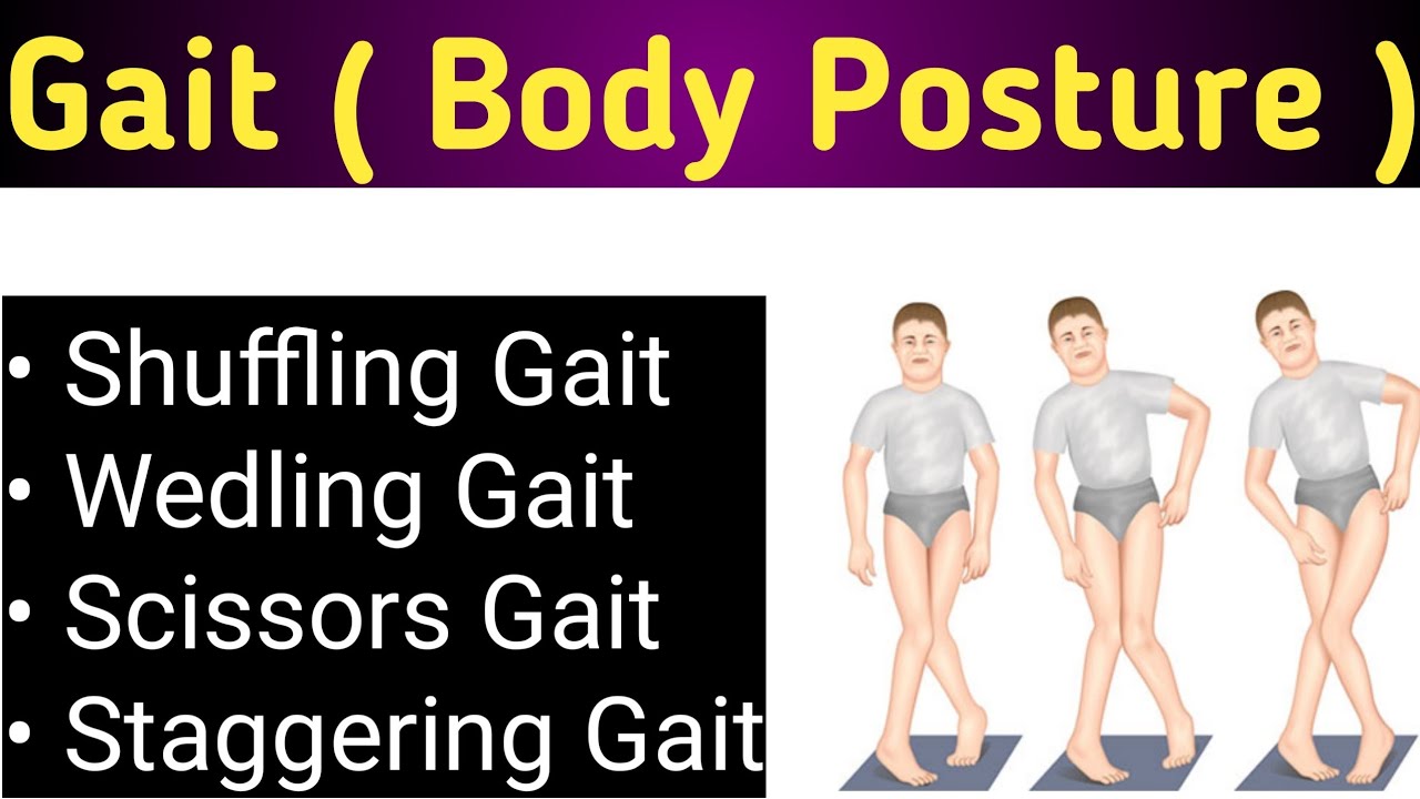 Gait ( Body posture) - YouTube
