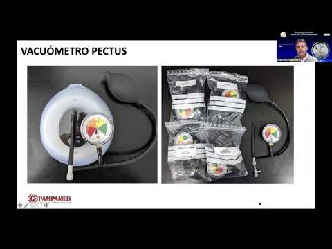 TELEVACUUM / VACUUM BELL / PECTUS EXCAVATUM - YouTube