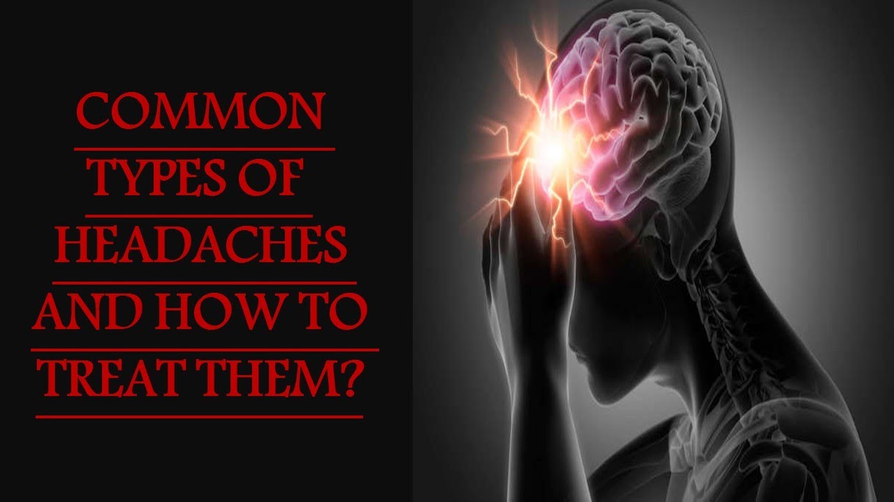 COMMON TYPES OF HEADACHES AND HOW TO TREAT THEM? - YouTube