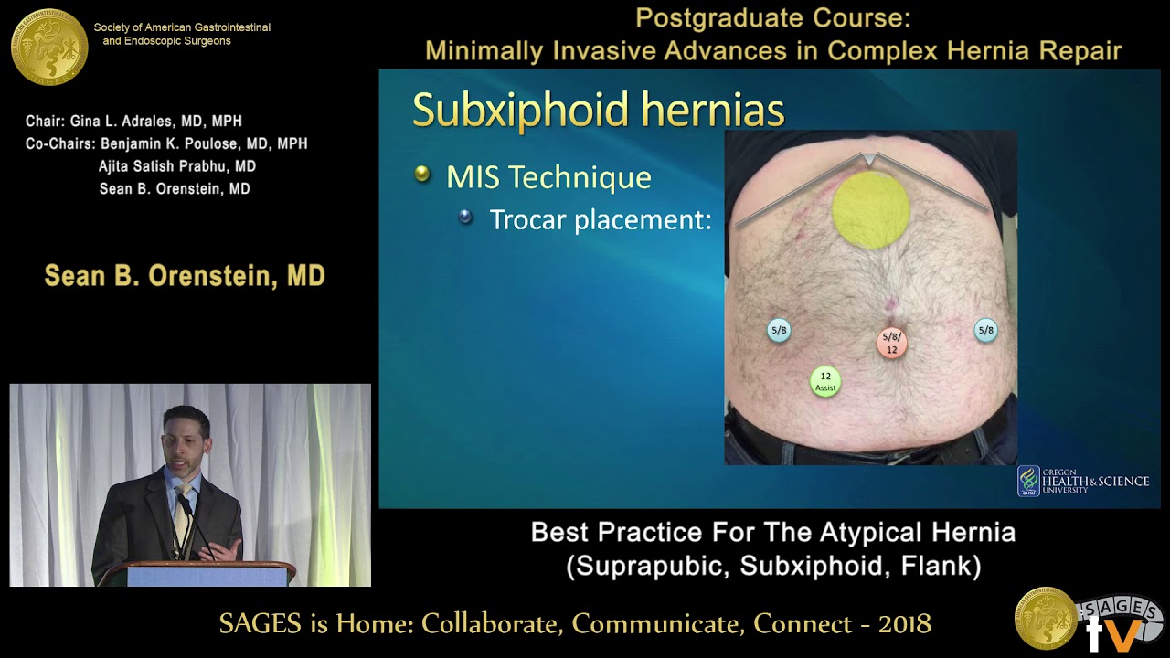 Best practice for the atypical hernia (suprapubic, subxiphoid, flank ...
