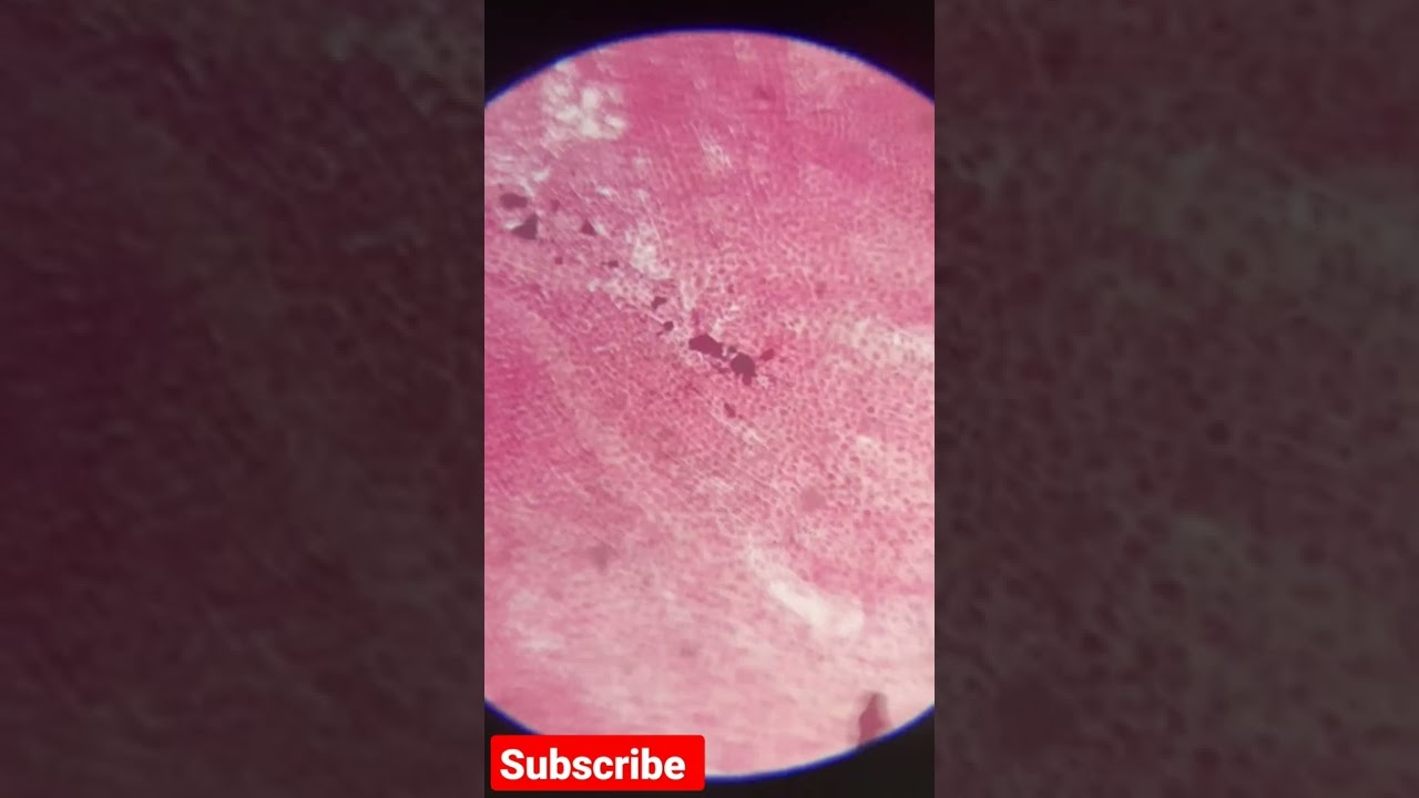 Squash preparation of onion root tip (Cell stage - Mitosis under ...