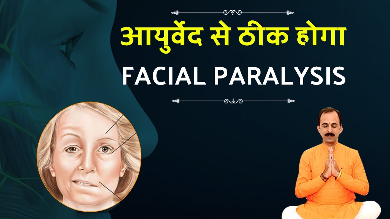 Kyaa aapko bhi hai Facial Paralysis ki takleef? | Ayurvedic Treatment ...