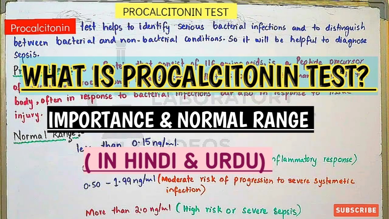What Is A Procalcitonin Lab Test For at Claude Martinez blog