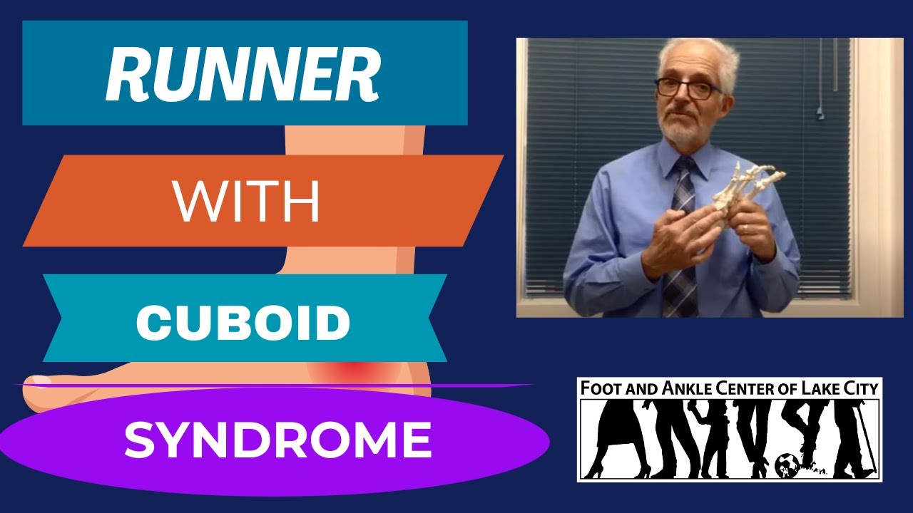 Case Study of Runner with Cuboid Syndrome - YouTube