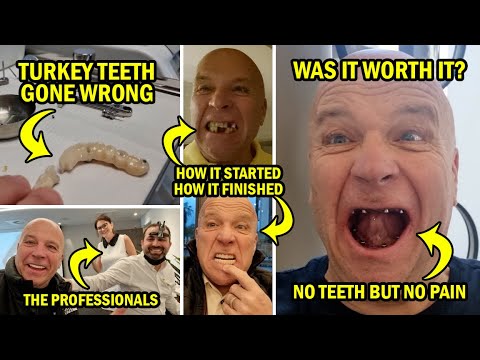 TURKEY TEETH | We had a problem | THE FULL STORY - YouTube