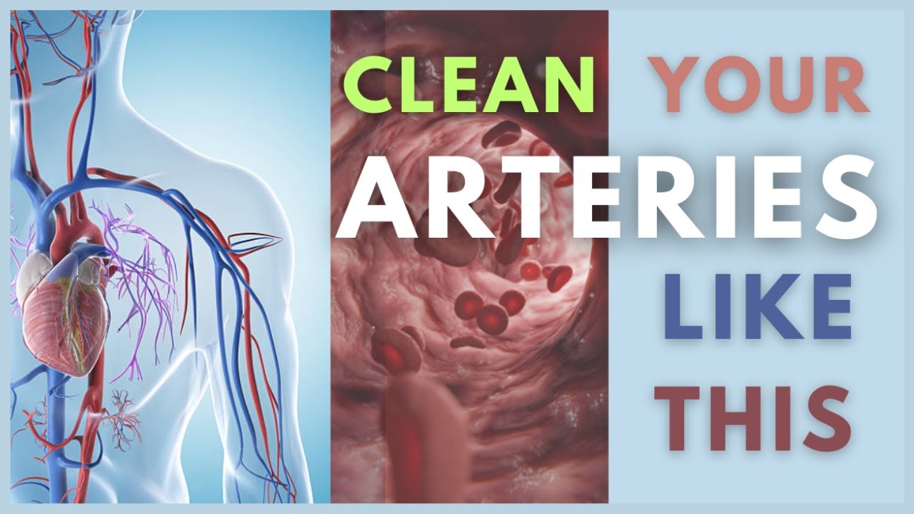 OVER 40 YEARS OLD YOU HAVE TO CLEAN YOUR ARTERIES LIKE THIS. - YouTube