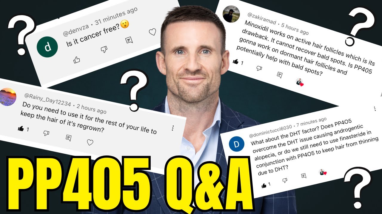Hair Loss Doctor Answers Your Top 5 Questions About PP405 | Game ...