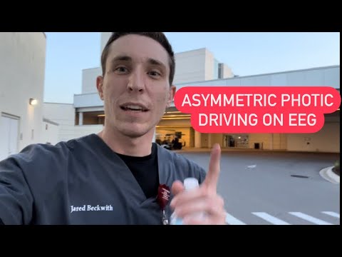 Asymmetric Photic Driving on EEG of Uncooperative Patient - YouTube