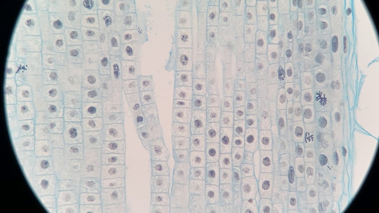 Mitose Da Raiz Foto_nucleo_m5a.jpg