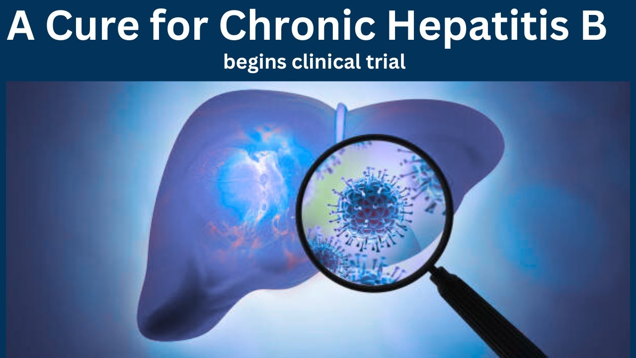 A Cure for Chronic Hepatitis B begins clinical trial by Precision ...