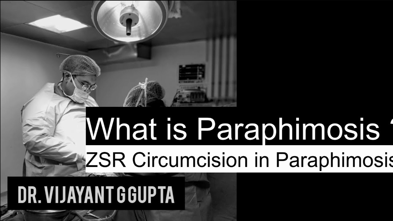 What is Paraphimosis | ZSR Circumcision in Paraphimosis - YouTube