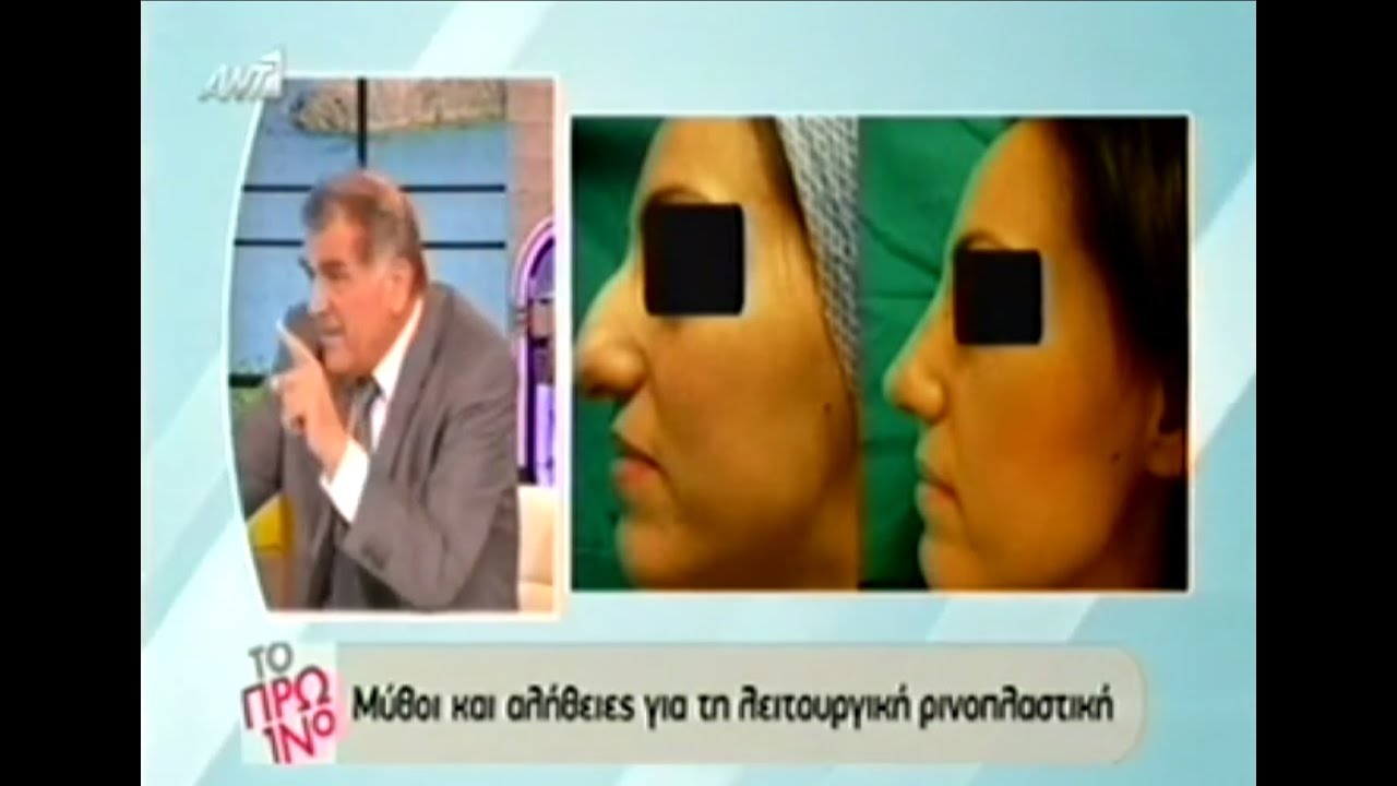 ΠΡΩΙΝΟ ΑΝΤ1 ΜΕ ΤΟΝ ΑΘ. ΣΚΟΥΡΑ : ΛΕΙΤΟΥΡΓΙΚΗ ΡΙΝΟΠΛΑΣΤΙΚΗ - YouTube