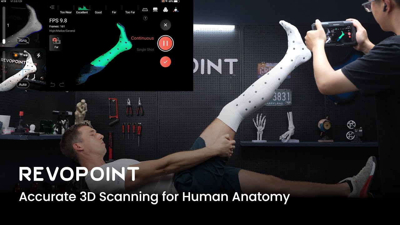 Revopoint 3D Scanners: Accurate 3D Scans for Human Anatomy - YouTube